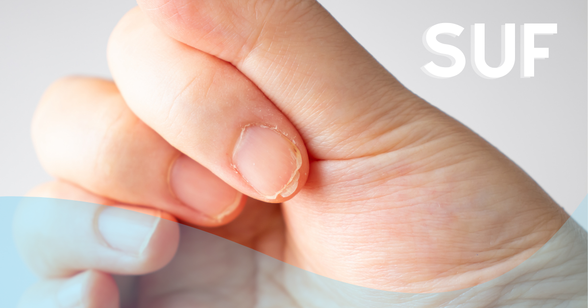 Conteúdo para Profissionais: Você sabe o que é ‘SUF’? - PROUNHA ...